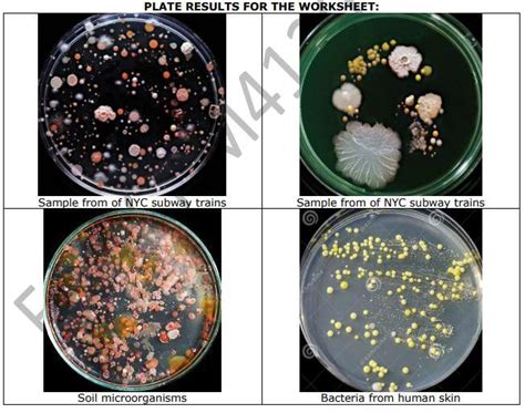 Table Observations On The Isolation Plates Source Chegg
