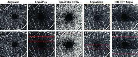 Results Of Motion Artifacts Detection Of 3×3 Mm 2 Scans Of A Same