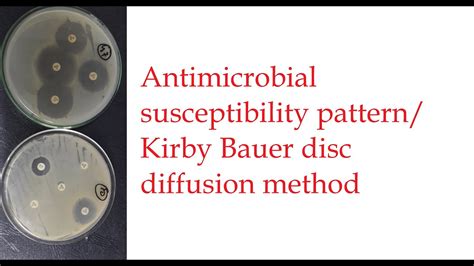 What Is Kirby Bauer Method At Jaxon Woods Blog