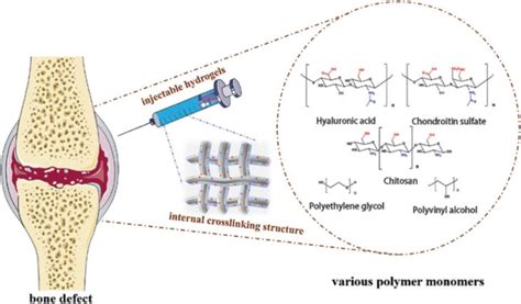 Advanced Injectable Hydrogels For Bone Tissue Regeneration Pmc