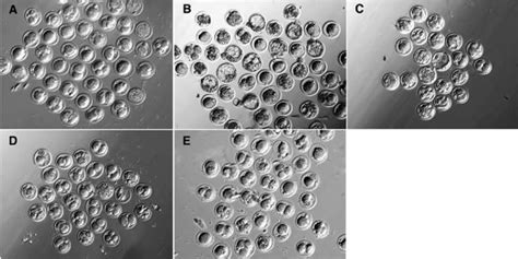 Requirement Of The Oocyte Nucleolus For The Early Step Of Pronucleus Download Scientific