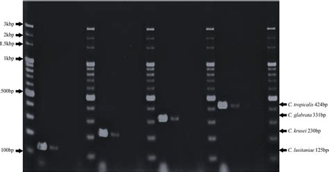 One Step Multiplex Pcr For Simultaneous Detection And Identification Of Eight Medically