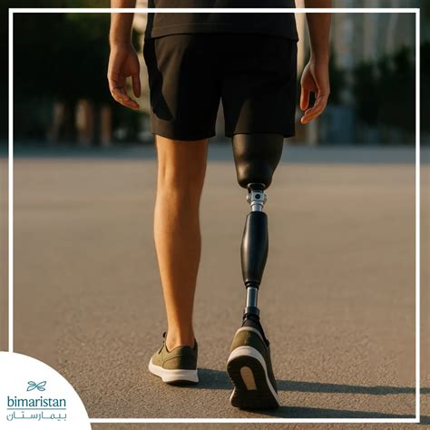 Sports Prosthetics High Performance Limbs For Amputees