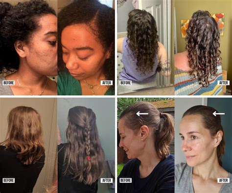 PROBLEMATIC SCALP TREATMENT The Innate Life