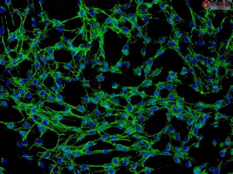 Human Thymus Fibroblasts Htyf