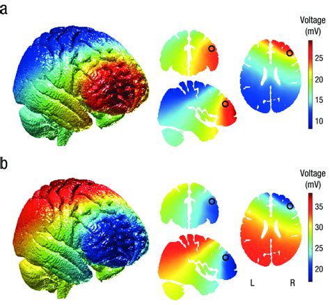 Electric Field Simulation For A Anodal And B Cathodal Transcranial Download Scientific