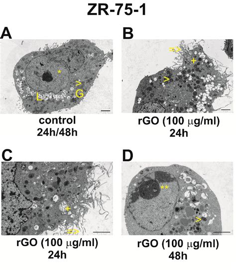 Figure 7 From The Synergistic Effect Of Reduced Graphene Oxide And Proteasome Inhibitor In The