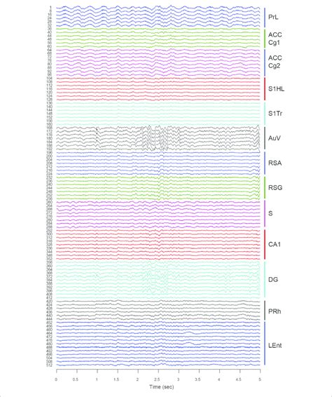 Large Scale Local Field Potentials Lfp Simultaneously Recorded From