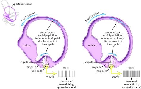 Benign Paroxysmal Positional Vertigo Canalithiasis Or 42 Off