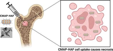 内化羟基磷灰石纳米颗粒与叶酸功能化姜黄素修饰形式结合促进骨肿瘤细胞坏死 Acs Applied Nano Materials X Mol