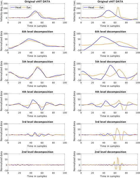 Wavelet Transform Application In Vhit Responses Plots On The Left Download Scientific Diagram