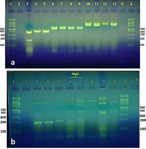 Pcr Detection Of Carbapenemase Resistance Genes Kpc Ndm Oxa A And