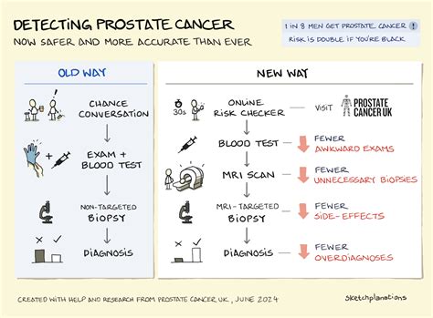 Detecting Prostate Cancer Old Way New Way Sketchplanations