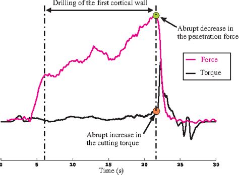 Figure 1 From A Robotic Bone Drilling Methodology Based On Position Measurements Semantic Scholar