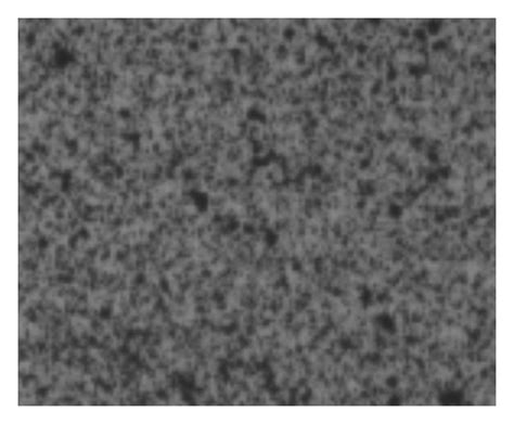 A Example Of A Grey Scale Speckle Pattern On The Surface Of Interest
