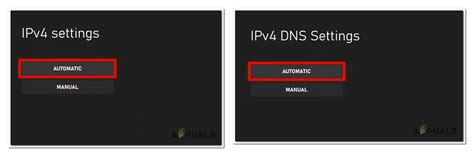 fix can t connect to your dhcp server error in xbox