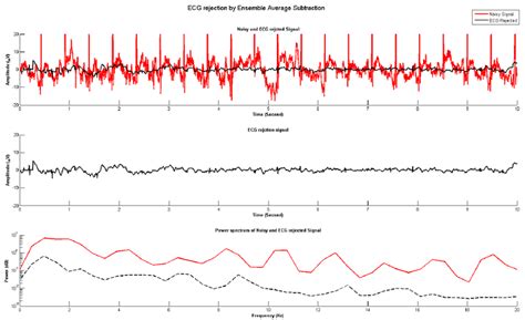 2 The Ecg Elimination By Using Wavelet Denoising Method Download