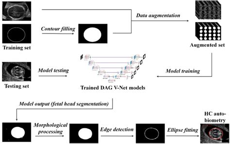 Fetal Ultrasound Image Segmentation For Automatic Head Circumference Biometry Using Deeply
