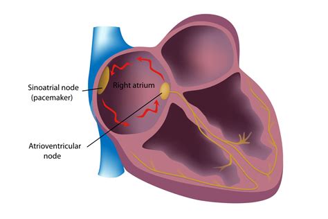 Topic Atrial Flutter 12 Lead Ecg Course Acls Certification Association