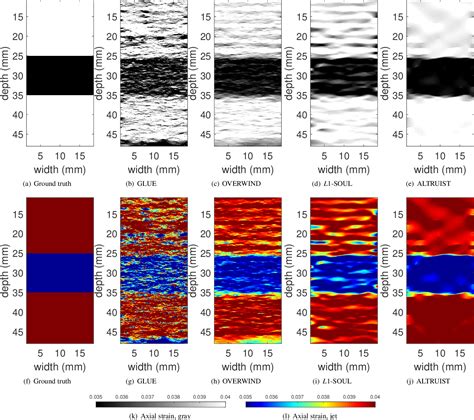 figure 1 from ultrasound strain imaging using admm semantic scholar