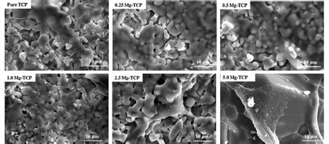 morphology of the cells on pure and mg doped tcp samples after 24 h
