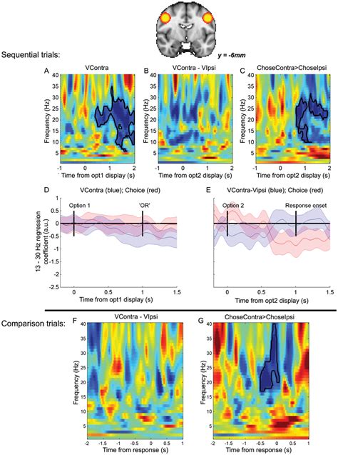 Lateral Premotor Cortex Similar To Primary Motor Cortex Shows