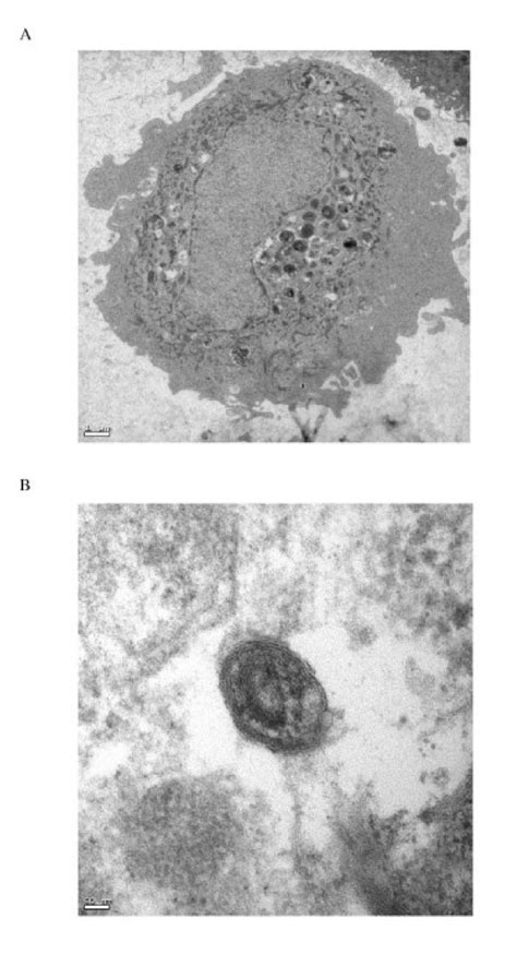 Transmission Electron Micrographs Of Human Type II Pneumocytes Cultured Download Scientific