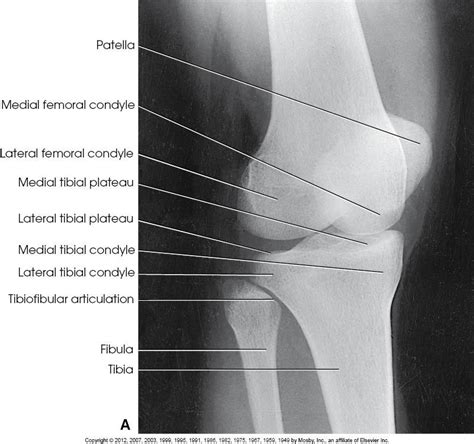 Internal Rotation Knee