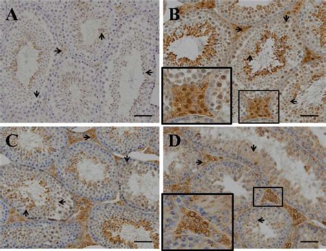 Immunohistochemical Detection Of Nrf2 In The Testes Of Mice Sections