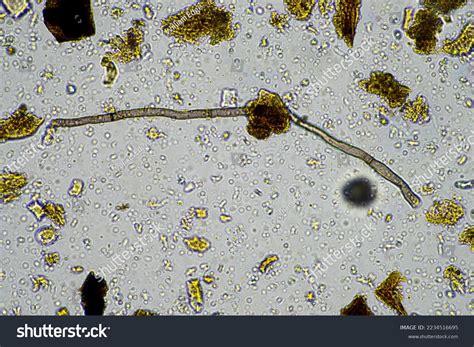 289 Root Soil Microorganism Images Stock Photos Vectors Shutterstock