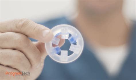 Novel Device That Prevents Preterm Birth Developed In Israel The Jerusalem Post