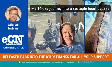 Im Back After A Sextuple Heart Bypass E Channelnews Com