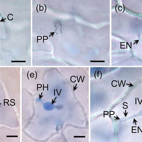 Light Micrographs And Scanning Electron Micrographs Sem Showing