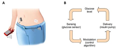 An Illustrative Representation Of A Closed Loop Insulin Delivery