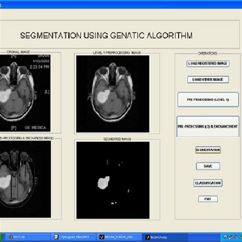 Segmented Image Screen Shot Target Image Corresponding Ga Segmentation Download Scientific Diagram