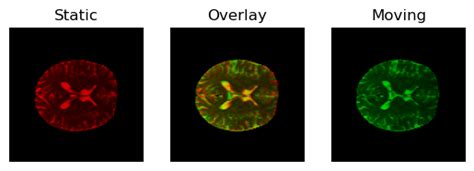 Dipy — Dipy 190 Documentation