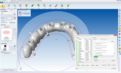 worknc dental 3 to 5 axis toolpaths