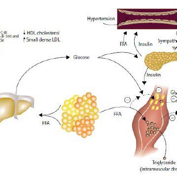 PDF Metabolic Syndrome