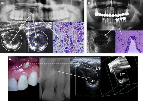 Present Status And Future Directions Imaging Techniques For The