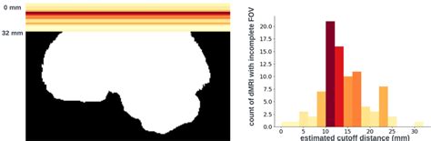 논문 리뷰 Multi Modality Conditioned Variational U Net for Field of View