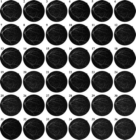 Zernike Moments Feature Maps For Training Image 1 From Drive Dataset Download Scientific