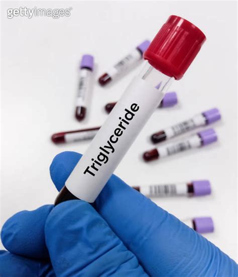 Blood sample for Triglycerides Tg test to risk of heart disease and stroke 이미지