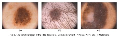 Shows The Research Design Regarding The Proposed Method Bpnn Sa From