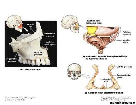Fracture Maxilla Pptx Dr Wafaa Muhadharaty