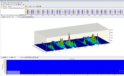 Sonus Vue Pro Advanced Ultrasound Analysis Software Iriss