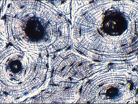 Micrograph Of Compact Bone Diagram Quizlet