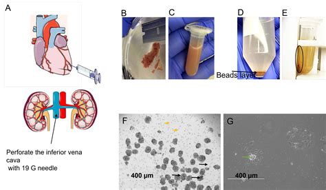Video Isolation Of Conditionally Immortalized Mouse Glomerular Endothelial Cells With