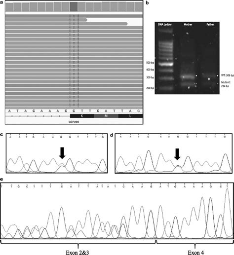 A The Integrative Genomics Viewer Igv Sequence Data For Case 2 Download Scientific Diagram