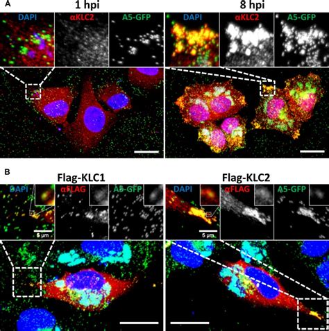 Vaccinia Virus Protein Complex F12e2 Interacts With Kinesin Light