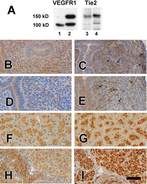 Antigen Retrieval For Light And Electron Microscopy IntechOpen